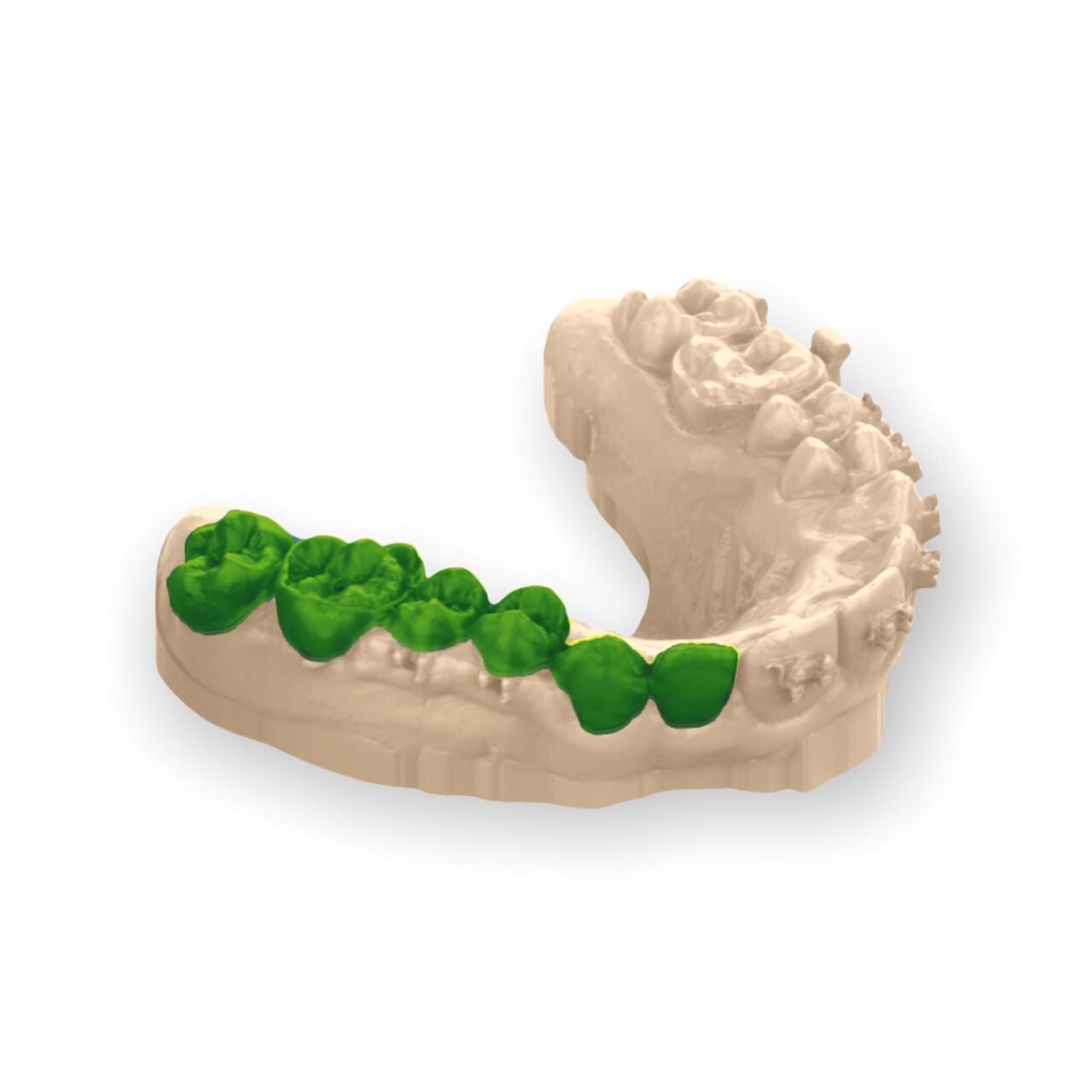 Add Our Lab And Get Your First Case Free | Clear Essix Retainers & 3D ...